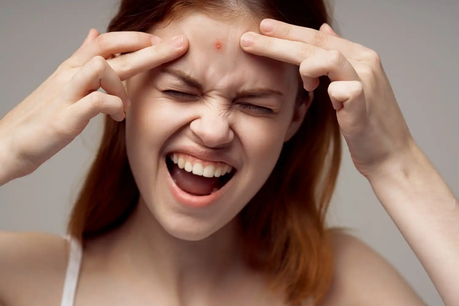Stress and Hormones: Acne Causes Explained